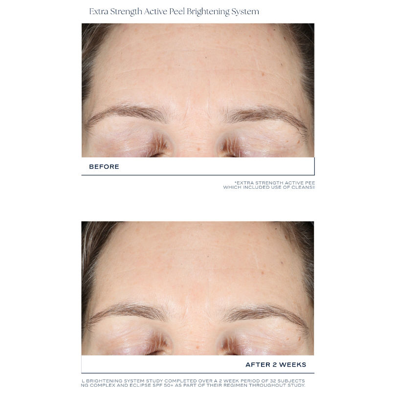 extra-strength-active-peel-brightening-system - TOP CLINIC - Kosmetolog ...